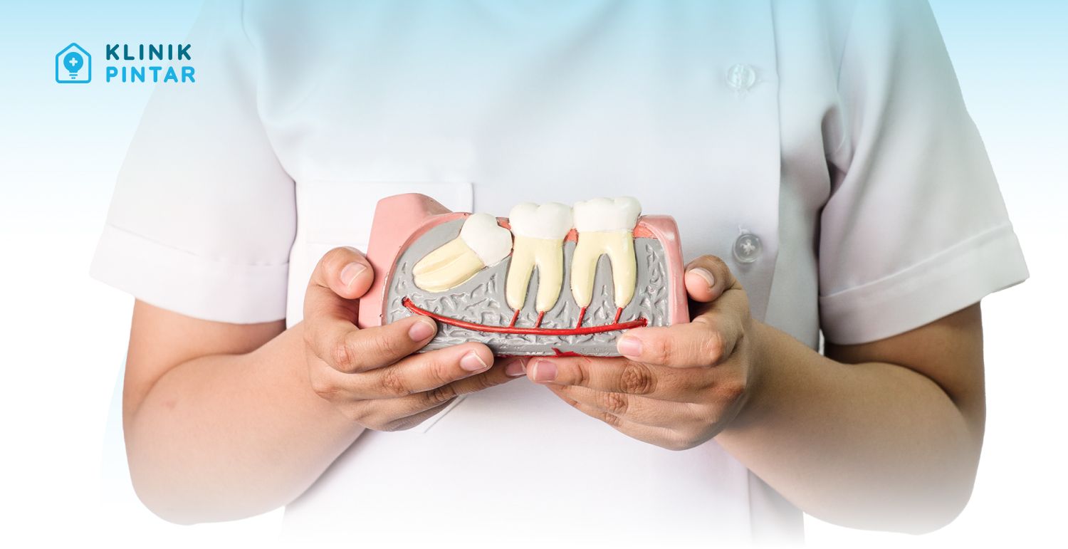 Mengenal Apa Itu Gigi Impaksi dan Bagaimana Penanganannya