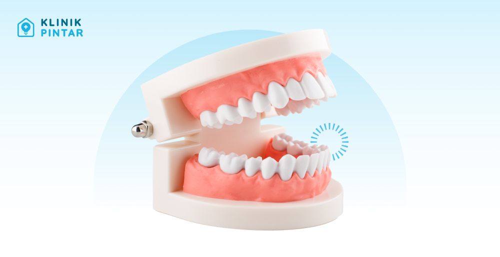 Apa Itu Odontogram? Berikut Penjelasan, Fungsi, dan Juga Manfaatnya